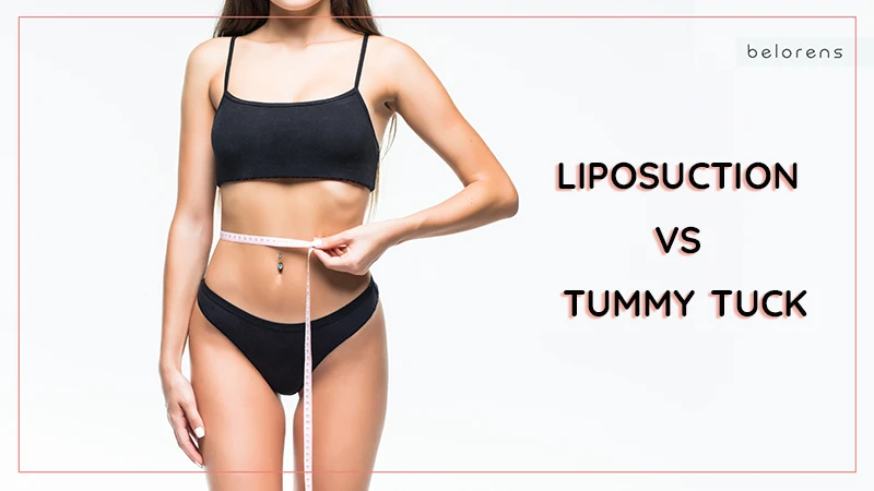 Liposuction Vs Tummy Tuck Abdominoplasty Belorens 4127