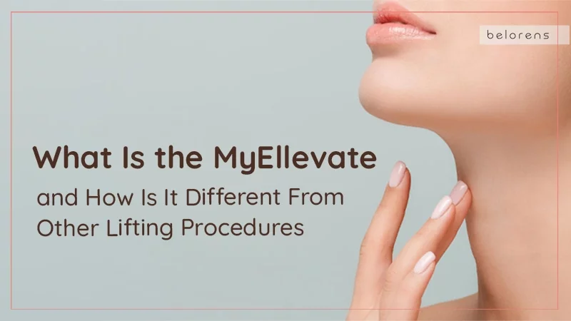 MyEllevate: Minimally Invasive Neck Contouring | Belorens