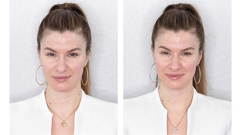 All You Need to Know About Skin Tone and Undertone | Belorens