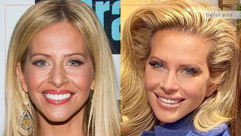 50 Celebrity Nose Jobs - before and after (Updated for 2024)