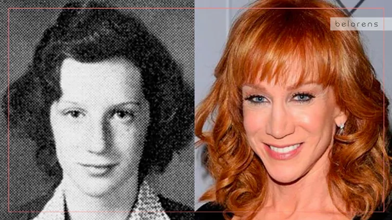 50 Celebrity Nose Jobs - before and after (Updated for 2024)