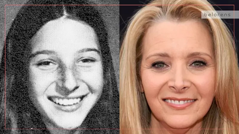 50 Celebrity Nose Jobs - before and after (Updated for 2024)