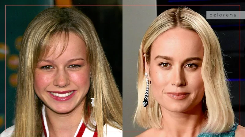50 Celebrity Nose Jobs - before and after (Updated for 2024)