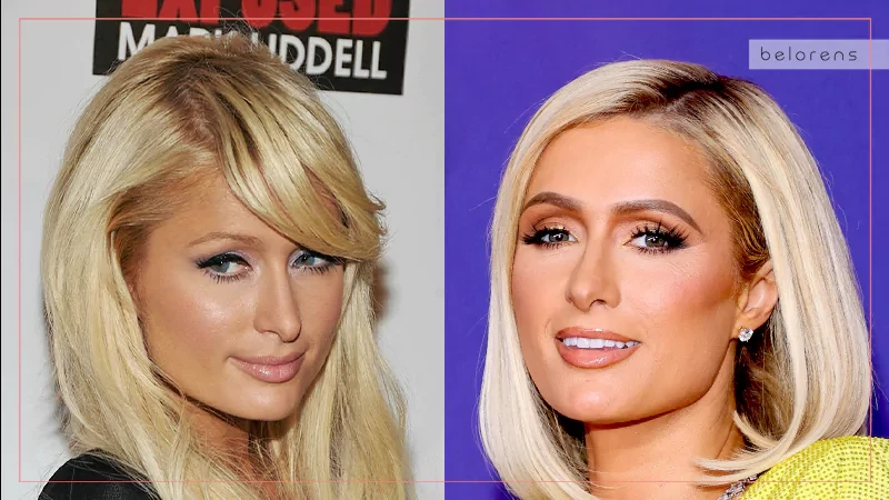 50 Celebrity Nose Jobs - before and after (Updated for 2024)