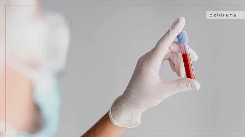 What to Expect Before Rhinoplasty | Belorens