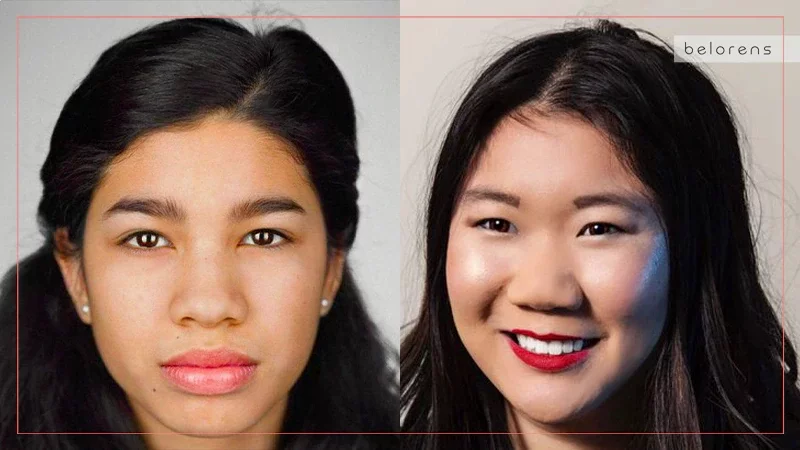 Types Of Asian Noses Types Of Nose Shapes: Variations By Race