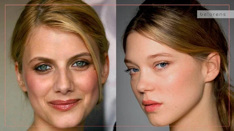 Types of Nose Shapes: Variations by Race & Ethnicity