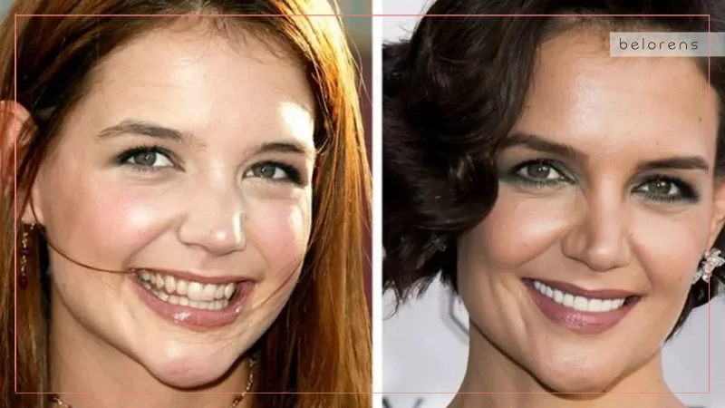 Katie Holmes Teeth Before And After Katie Holmes Heads Into Good