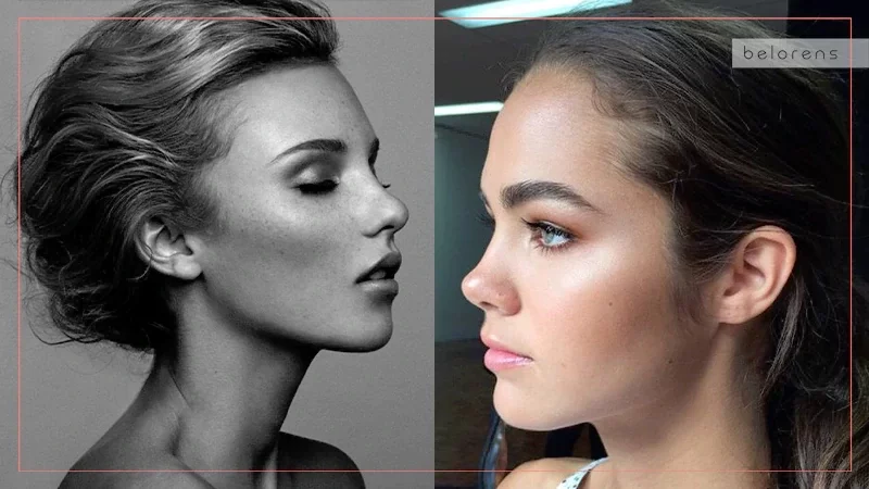 Types of Nose Shapes: Variations by Race & Ethnicity