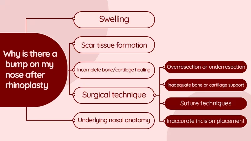 Bump on Nose After Rhinoplasty: Causes and Treatment