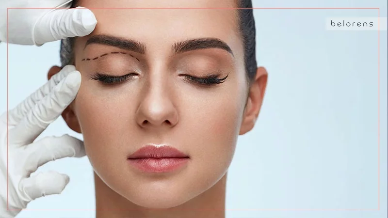 Blepharoplasty, Canthoplasty, Canthopexy: All Explained