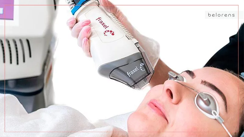 Pixel Laser Skin Resurfacing: Procedure, Cost, etc | Belorens