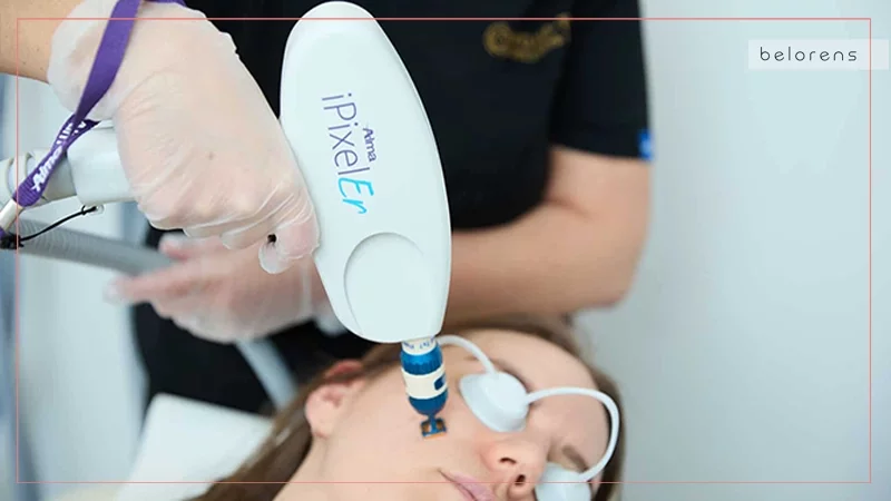 Pixel Laser Skin Resurfacing: Procedure, Cost, etc | Belorens
