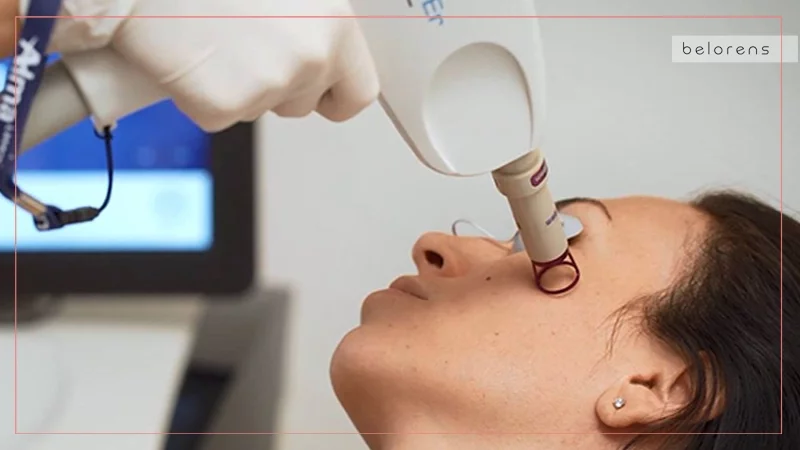 Pixel Laser Skin Resurfacing: Procedure, Cost, etc | Belorens