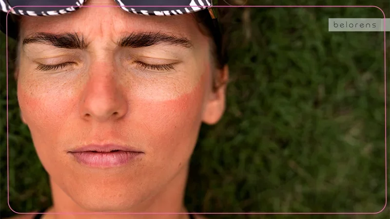 Fair Skin Care: Meaning, Routine, Tips & Treatment | Belorens
