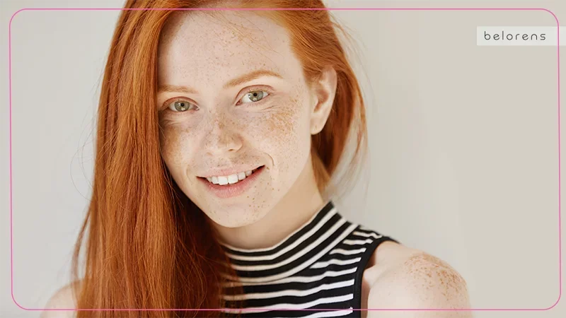 Fair Skin Care: Meaning, Routine, Tips & Treatment | Belorens