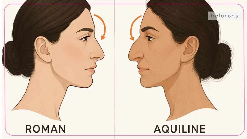 Roman Nose Guide: Shape, History, and Aesthetics | Belorens