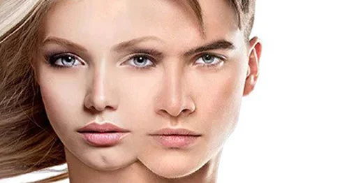 Facial Masculinization Surgery: Procedures, Photos | Belorens